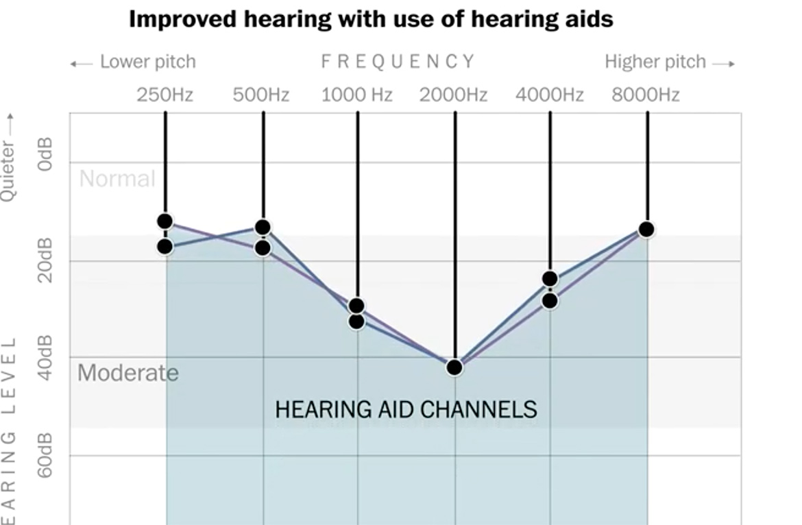 What Hearing Loss Sounds Like | - Technology, Science & Other News